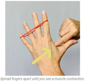 Top 5 Hand Strengthening Exercises For Stronger Hands - Virtual Hand Care