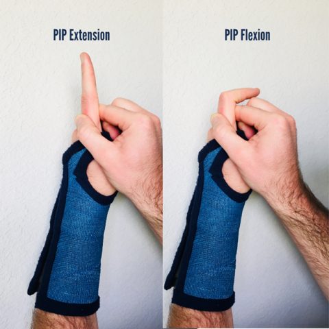 5 Gentle and Safe Finger Exercises in a Wrist Cast - Virtual Hand Care