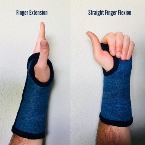 5 Gentle and Safe Finger Exercises in a Wrist Cast - Virtual Hand Care