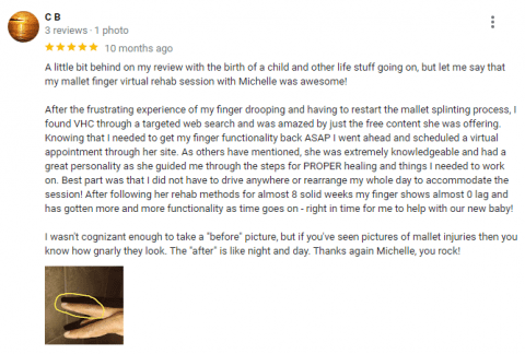 Mallet Finger Treatment - Virtual Hand Care